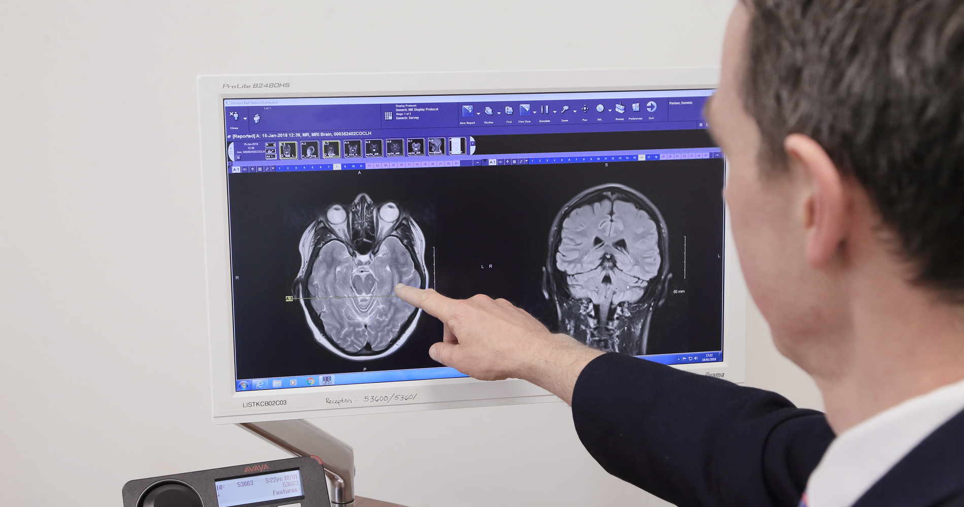 What is a Consultant Neurologist? - Dr Dominic Paviour